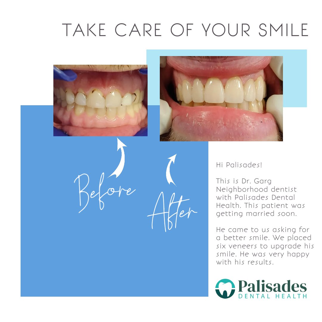 Take care of your smile - Palisades Dental Health
